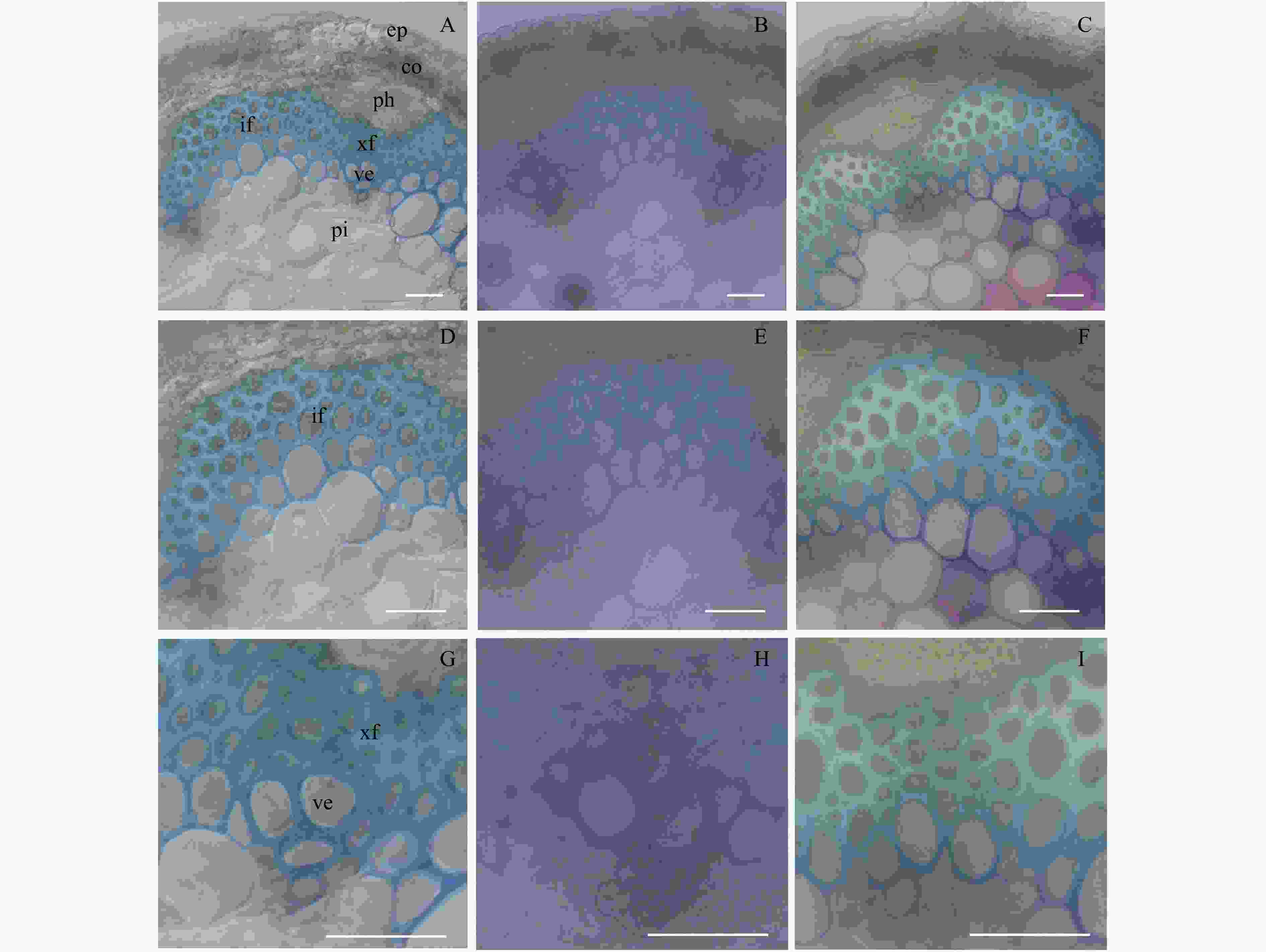杨树 PdKNAT 7基因调控拟南芥次生细胞壁厚度的功能研究